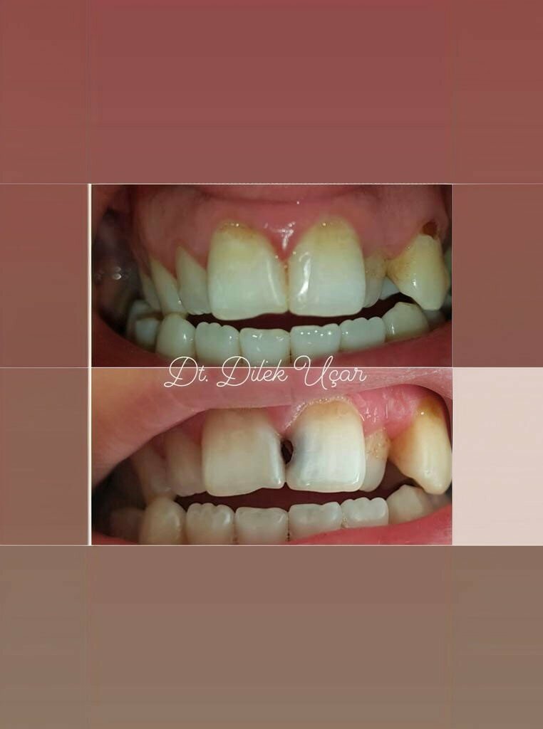 Özel ağız ve diş sağlığı klinikleri ve muayenehaneleri Diş Hekimi Dilek Uçar, Samsun, foto