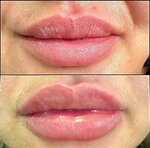Beauty sphere Almaty (Kenesary han kóshesі No:46), kozmetoloji, kozmetik salonları  Almatı'dan