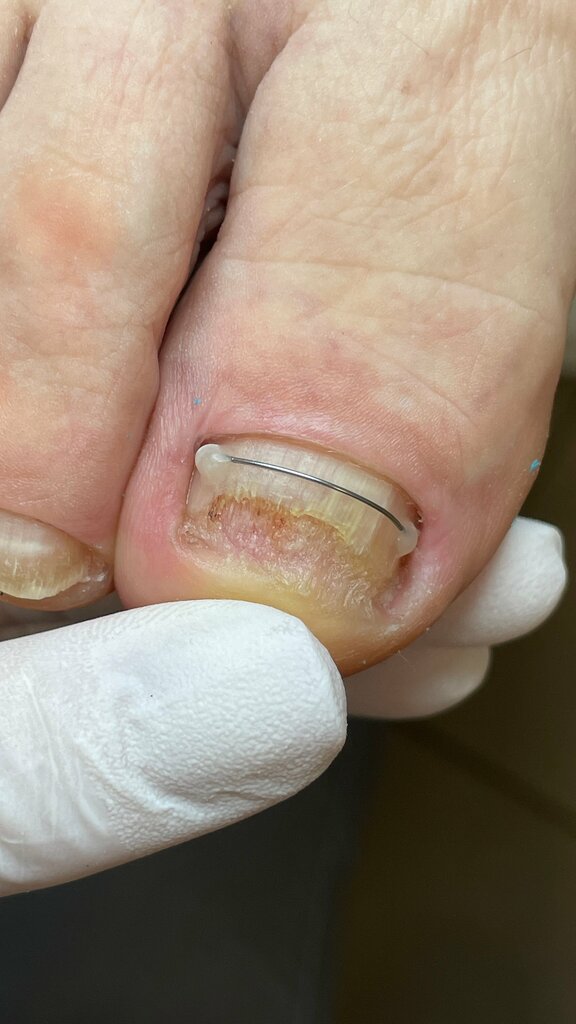 Podoloji Кабинет подолога, Minsk, foto