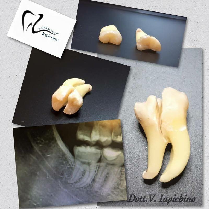 Özel ağız ve diş sağlığı klinikleri ve muayenehaneleri Studio Odontoiatrico Iapichino, Calabria, foto