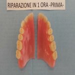 A. T. M. Laboratorio Odontotecnico-Riparazioni Protesi Dentali Immediate (Emilia-Romagna, Bologna, San Lazzaro di Savena, Via Piave, 42), özel ağız ve diş sağlığı klinikleri ve muayenehaneleri  Emilia‑Romagna'dan