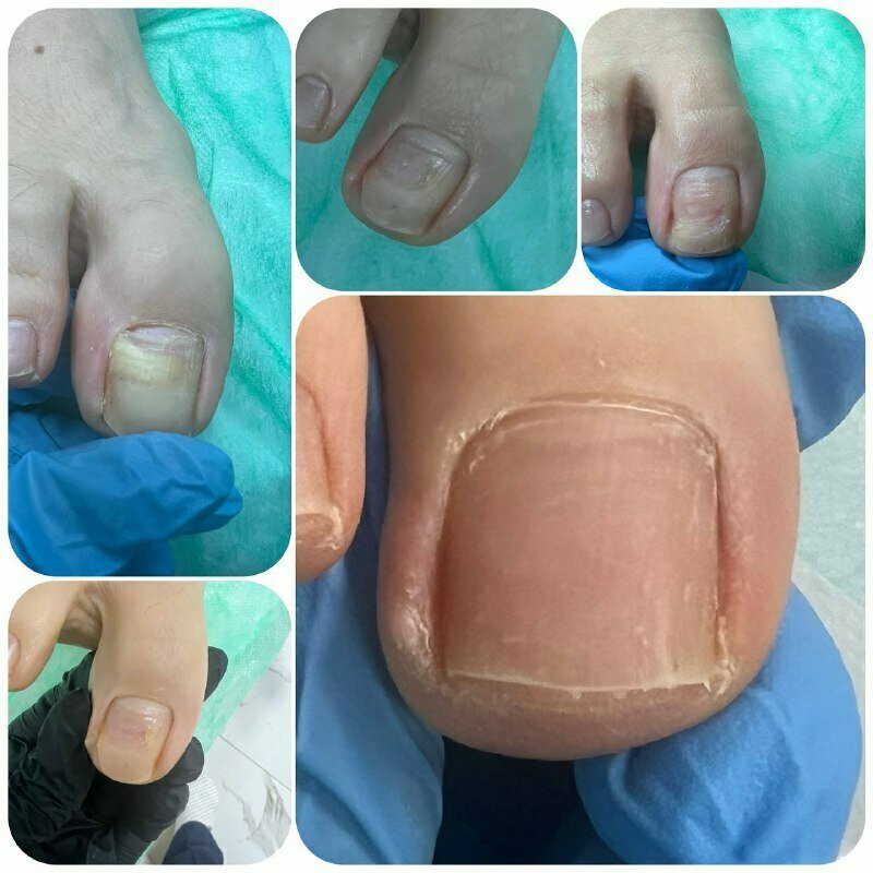 Podoloji Podologist Karetnikova D. O., Moskova, foto