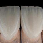 Cosmetic Art Dental Laboratory (Fortune Executive Tower, JLT Cluster T, Jumeirah Lakes Towers, Al Thanyah 5, Al Thanyah, Hadaeq Mohammed Bin Rashid, Dubai), diş laboratuvarı  Dubai'den