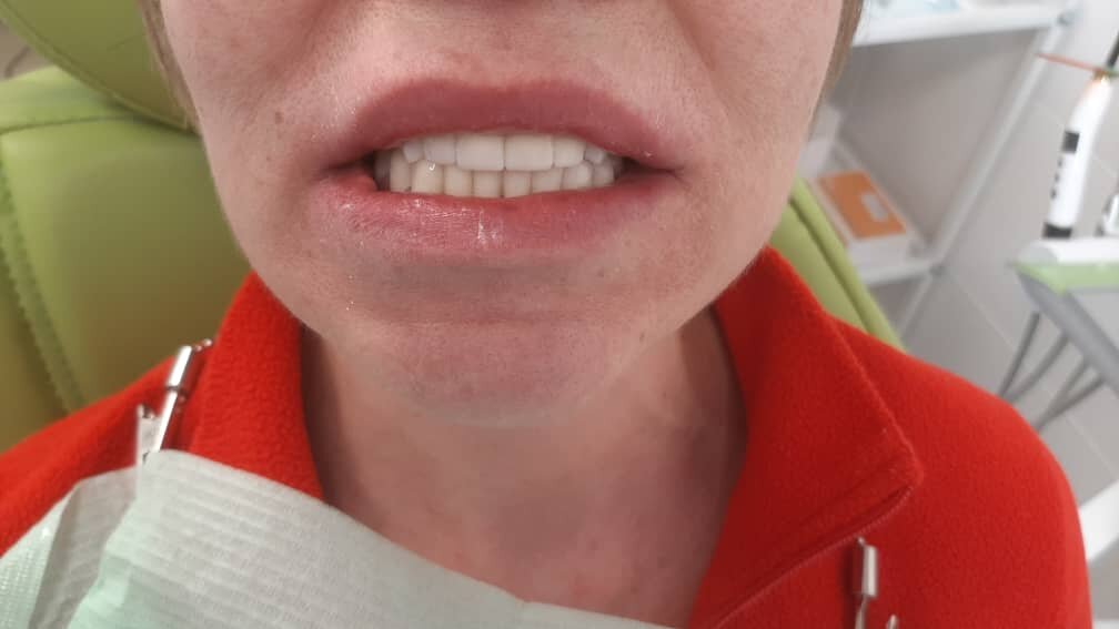 Özel ağız ve diş sağlığı klinikleri ve muayenehaneleri Вавилон, Boksitogorsk, foto