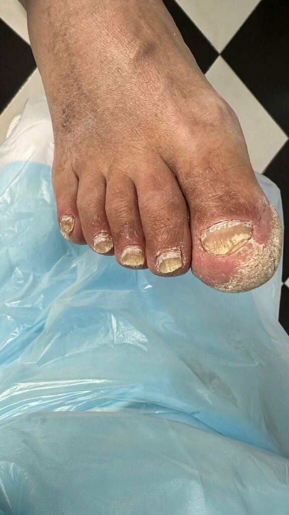 Manikür-pedikür Учебно-практикующий центр профессиональной подологии и педикюра Анны Кривошапкиной, Yakutsk, foto