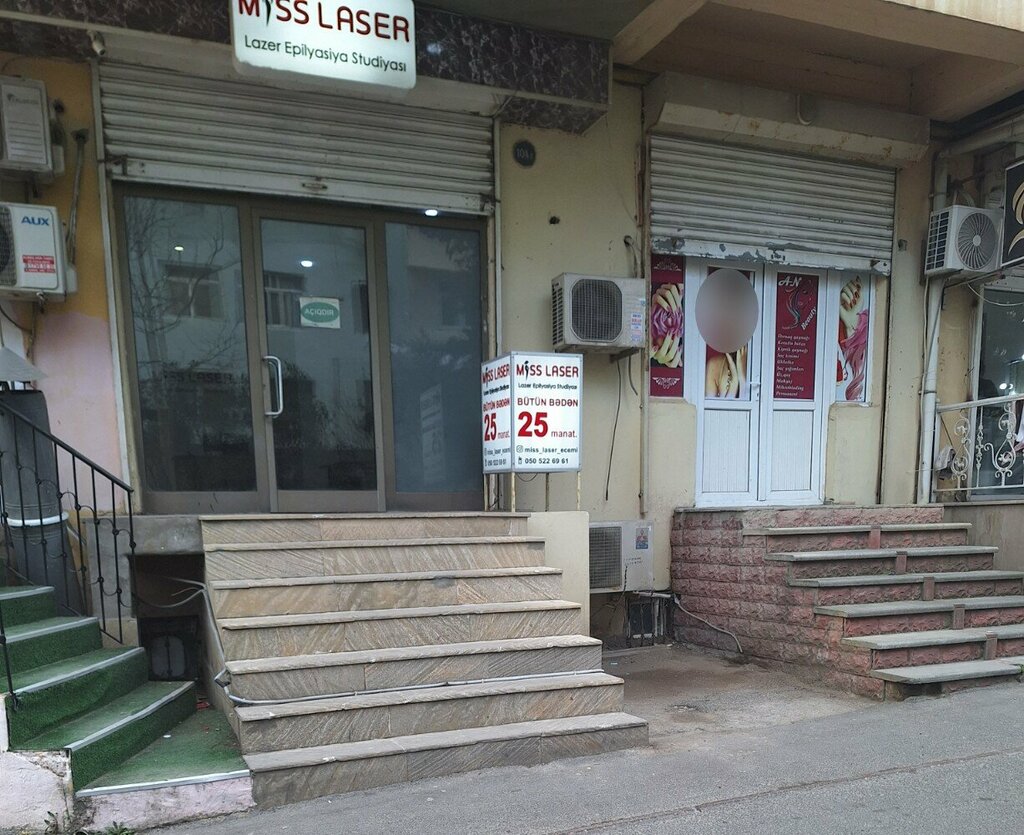 Epilasyon Miss Laser, Bakü, foto