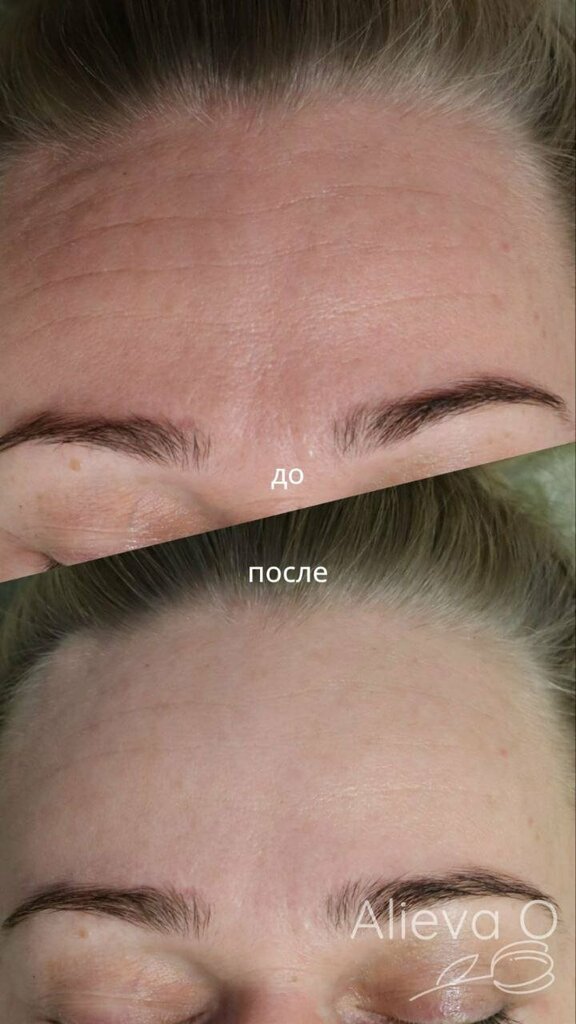 Masaj salonları Face & Wellness, Tolyatti (Togliatti), foto