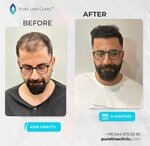 Pure Line Clinic (İstanbul, Kadıköy, Bağdat Cad., 19), tıp merkezleri ve klinikler  İstanbul'dan
