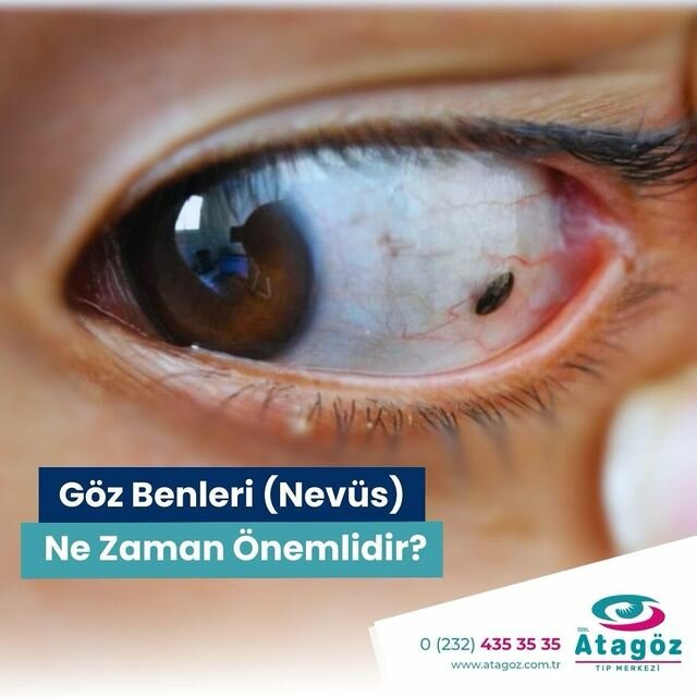 Tıp merkezleri ve klinikler Özel Atagöz Tıp Merkezi, İzmir, foto