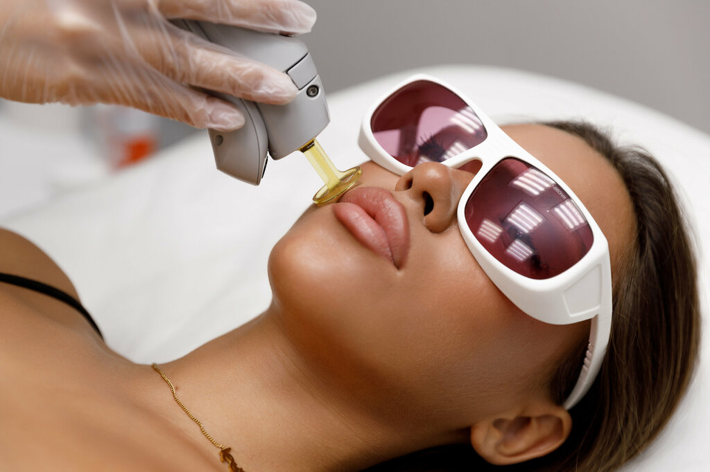 Epilasyon ProLaser, Çeliabinsk, foto