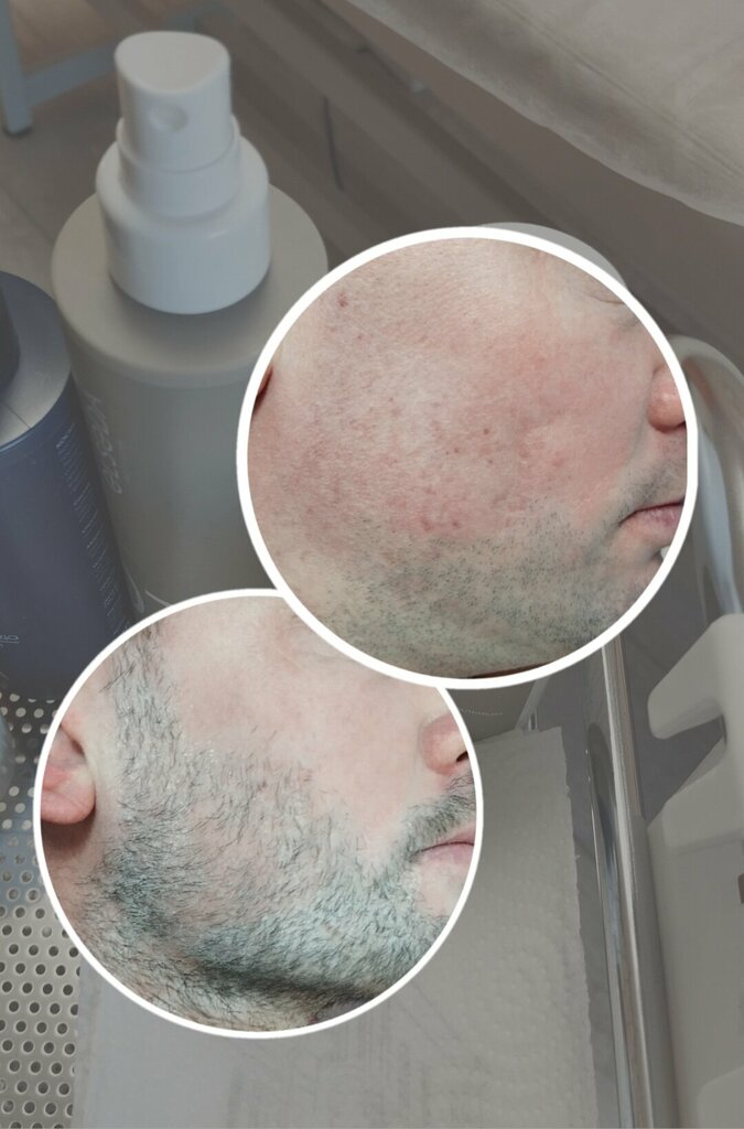 Ağda Studio wax depil, Barnaul, foto