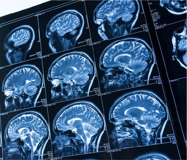 Tanı merkezleri Bodyscan Srl - Diagnostic Imaging Center, Cochabamba, foto