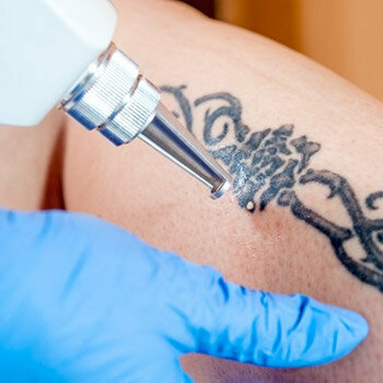 Tıp merkezleri ve klinikler Lazer Akademi, İstanbul, foto