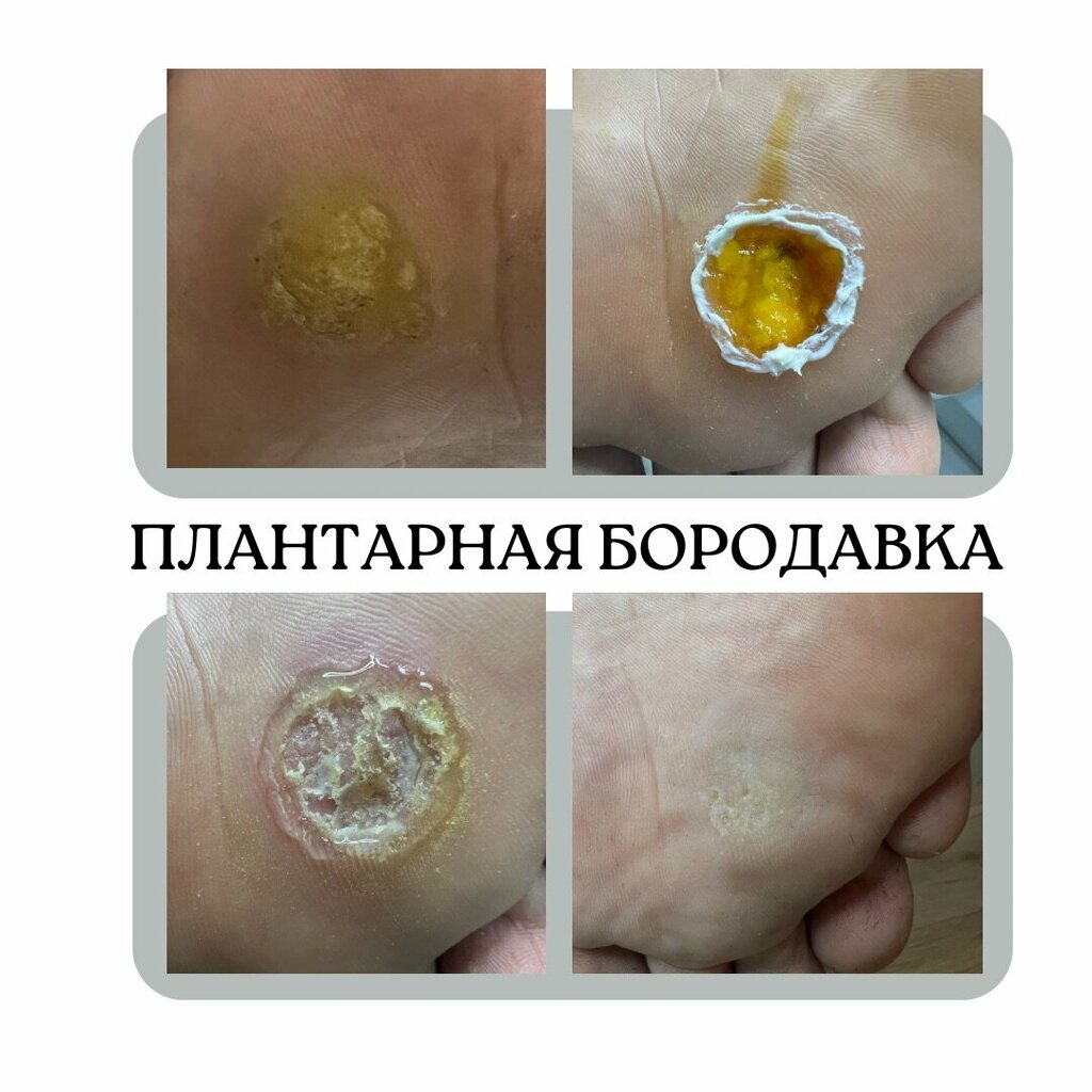 Podoloji Podologist Karetnikova D. O., Moskova, foto