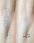 Studio Laser. beautyline (Krasnoarmeyskaya Street No:8), epilasyon  Liubertsy'den