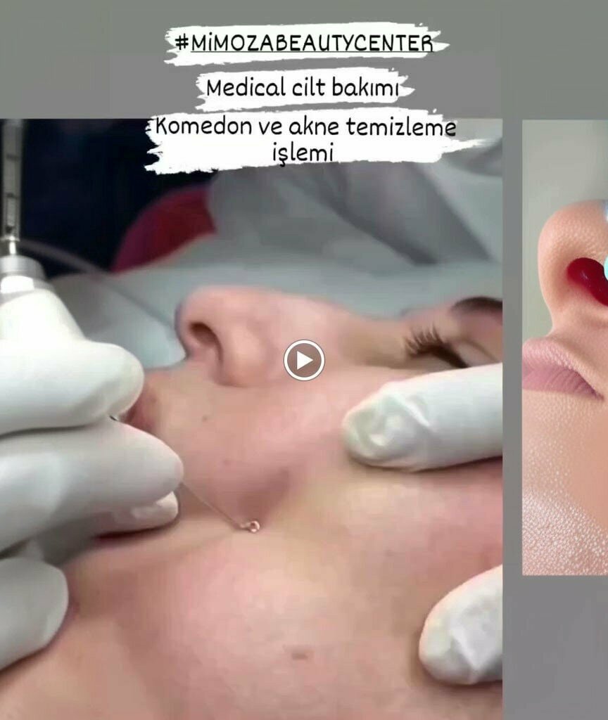 Güzellik salonu Mimoza Bay - Bayan Güzellik Merkezi Ordu Altınordu, Altınordu, foto