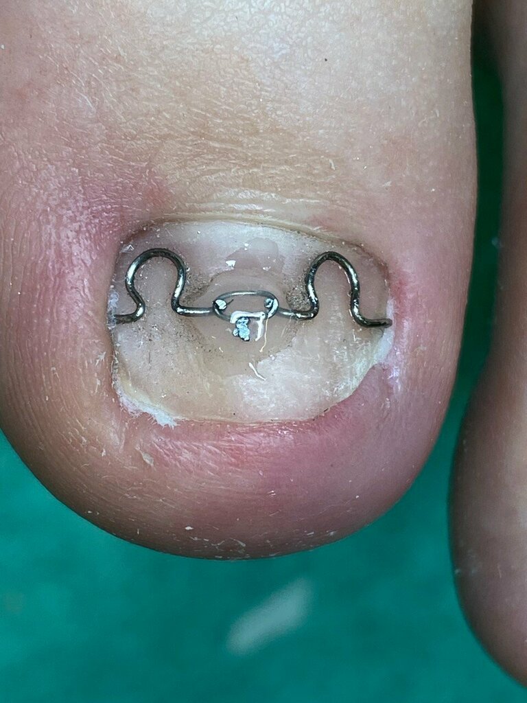 Podoloji Подолог Шувалова М. В., Dzerjinski, foto