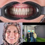 Özel Beydent Ağız Ve Diş Sağlığı Polikliniği (Konya, Beyşehir, Hacıarmağan Mah., 40761. Sok., 2), özel ağız ve diş sağlığı klinikleri ve muayenehaneleri  Beyşehir'den