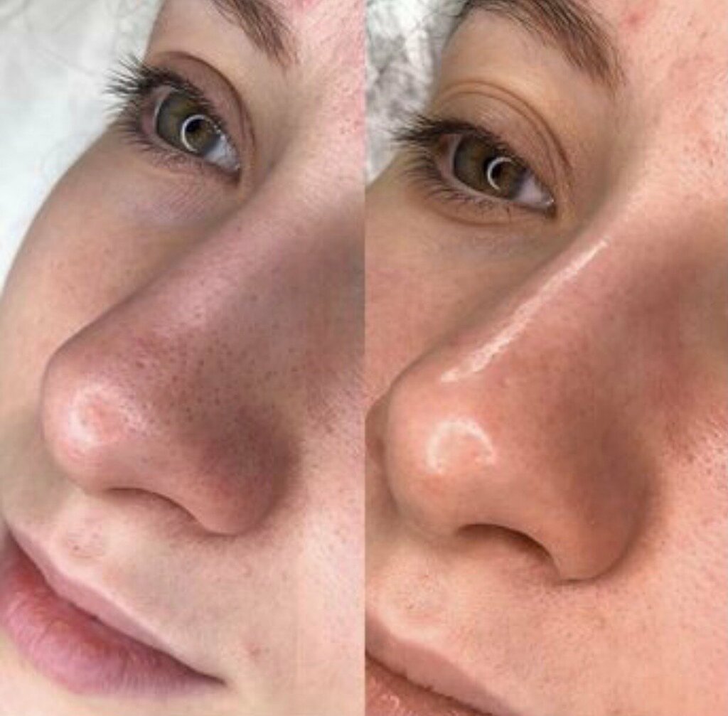 Kozmetoloji, kozmetik salonları Fern Cosmetology, Batum, foto