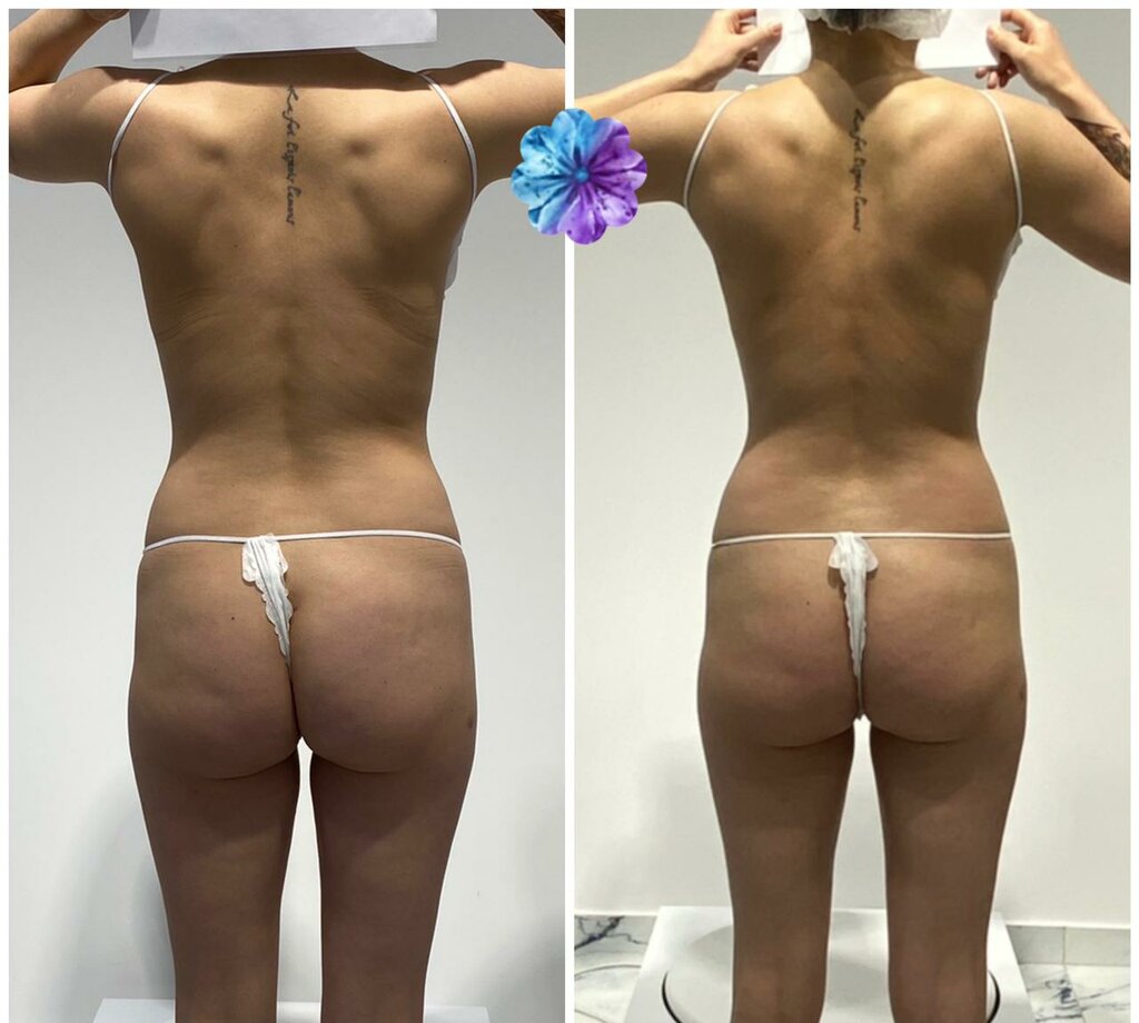 Masaj salonları Массажный кабинет Миляевой Д. А., Moskova, foto