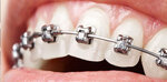 Studio Dentistico Avola Ciancio (Corso Gelone No:68, Siracusa), özel ağız ve diş sağlığı klinikleri ve muayenehaneleri  Syracuse'den