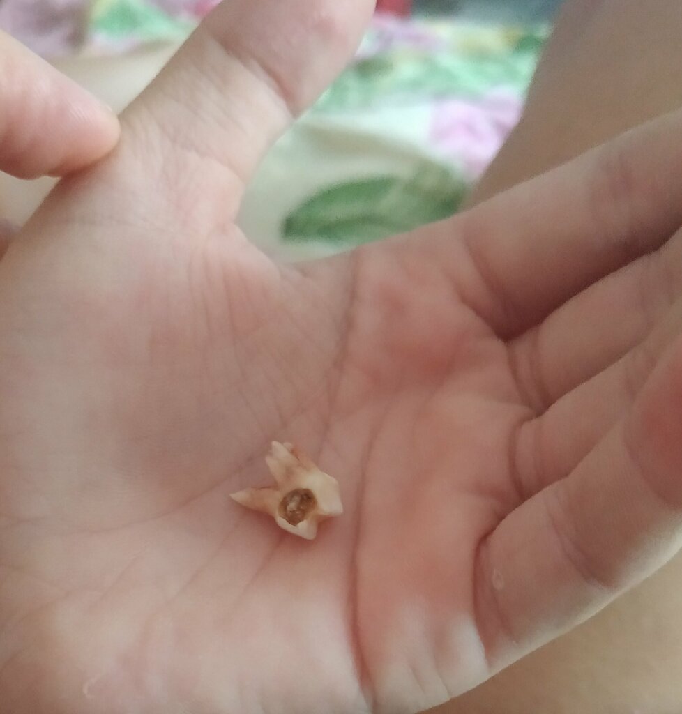 Diş sağlığı poliklinikleri Stomatologicheskoye otdeleniye, Kogbuz Kotelnichskaya tsentralnaya rayonnaya bolnitsa, Kotelnich, foto