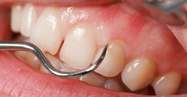 Özel ağız ve diş sağlığı klinikleri ve muayenehaneleri Mustafa Tuncer Ağız Ve Diş Sağlığı Polikliniği, Antalya, foto