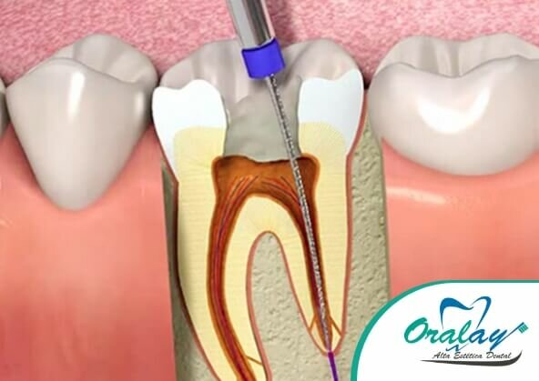Özel ağız ve diş sağlığı klinikleri ve muayenehaneleri Oralay Dental Clinic - Pueblo Libre, Lima, foto