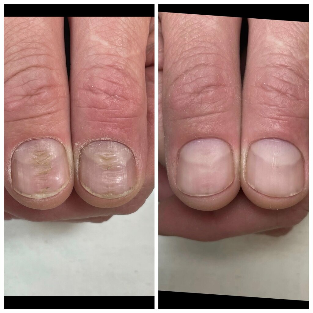 Podoloji Podiatrist Yeliseeva E. N., Almatı, foto