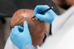 Hair Transplant (Distrital San Isidro, Calle Ricardo Angulo, 109), tıp merkezleri ve klinikler  Lima Bölgesi'nden