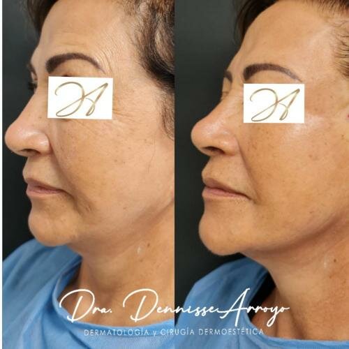 Özel muayenehaneler Dr. Dennisse Arroyo - Dermatology and Dermoaesthetic Surgery, Lima, foto