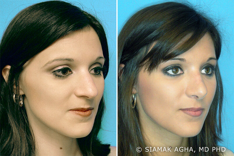 Plastik cerrahi klinikleri Dr. Siamak Agha, Facs, Newport Beach, foto
