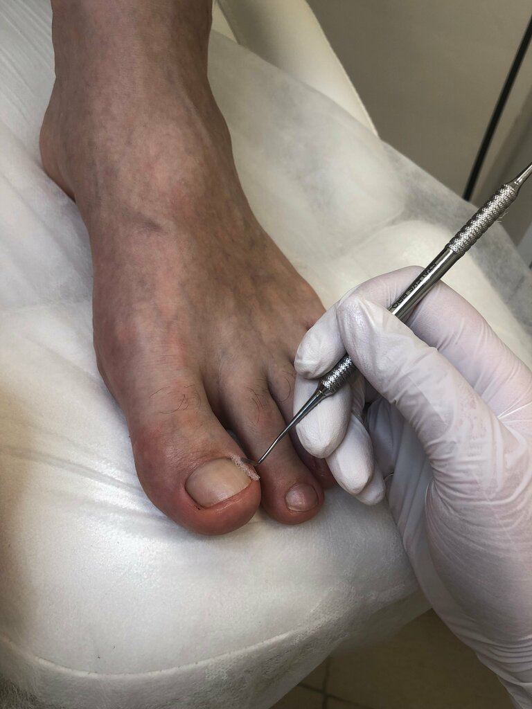 Podoloji Zabota O Stopah, Ufa, foto