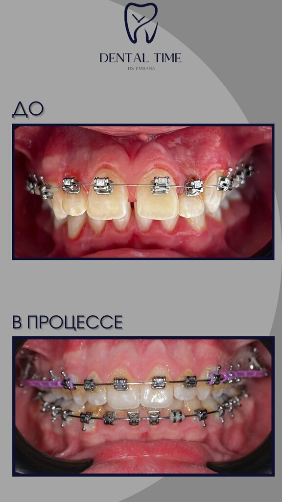 Özel ağız ve diş sağlığı klinikleri ve muayenehaneleri Dental Time, Astana, foto