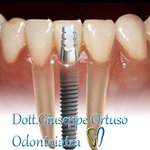 Dentista - Casilina - Dottor Ortuso Giuseppe - Pronto Soccorso Dentistico (Via Alessandro Benetti No:2, Rome), özel ağız ve diş sağlığı klinikleri ve muayenehaneleri  Roma'dan