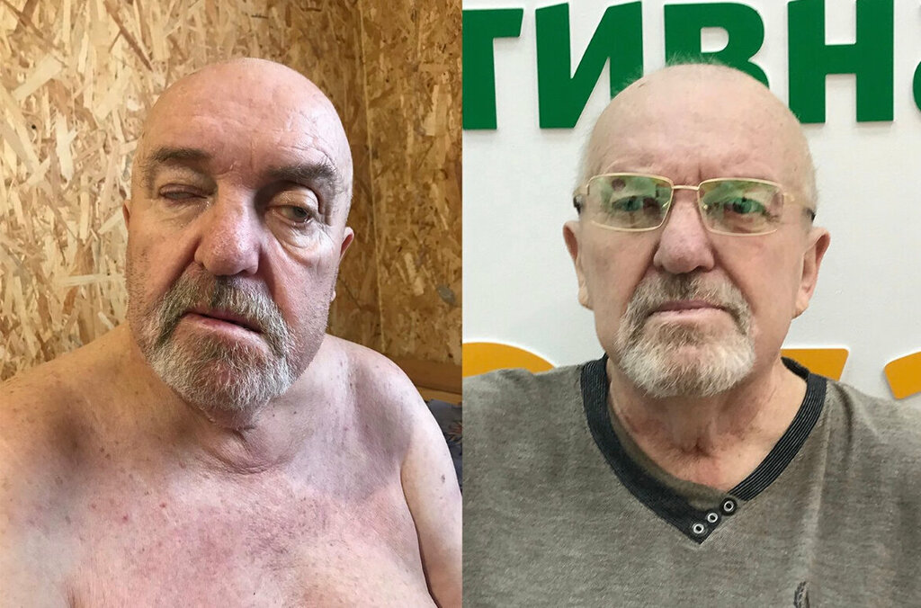 Tıp merkezleri ve klinikler Clinic of neurology, Sevastopol, foto