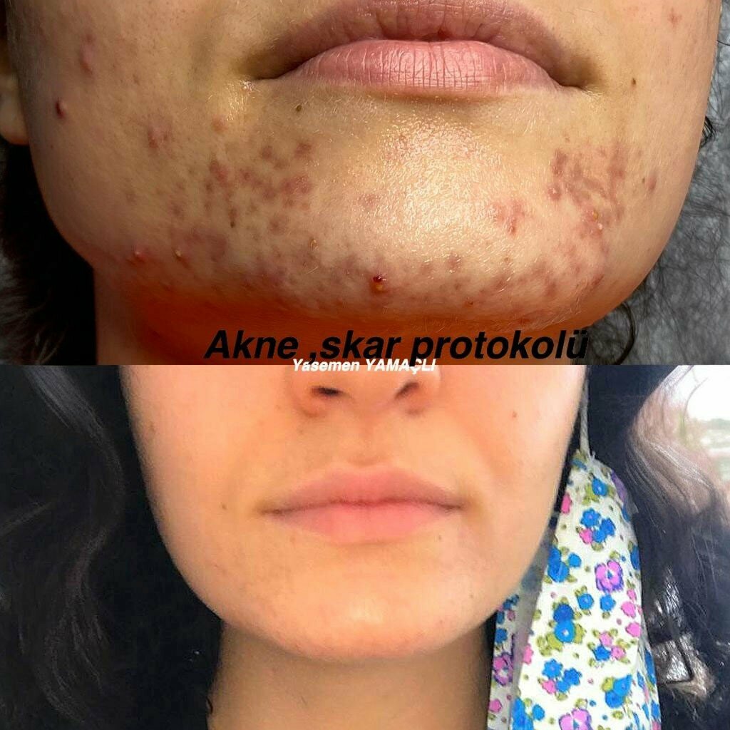 Güzellik salonu Yasemen Yamaçlı Beauty, Mersin, foto