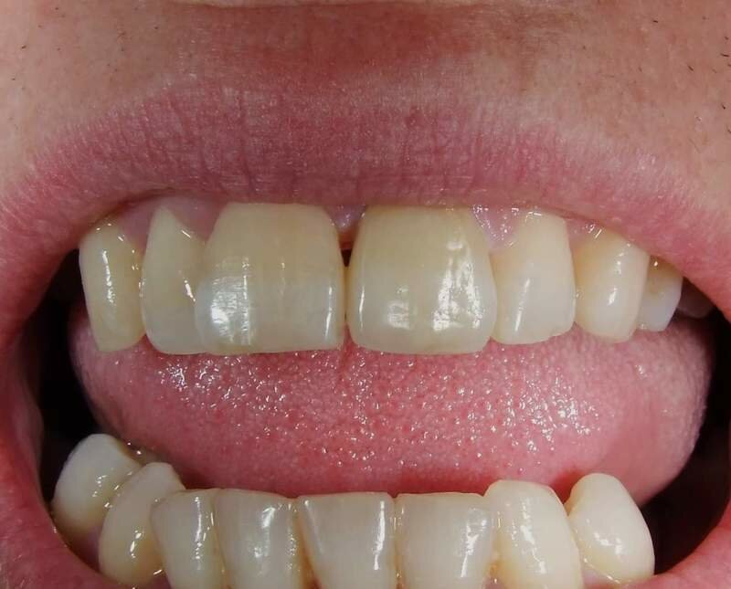 Özel ağız ve diş sağlığı klinikleri ve muayenehaneleri Laboratorio Odontotecnico Parravano Luigi, Lazio, foto