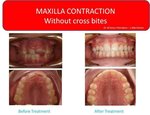 Studio Odontoiatrico Dr. M. Iancu - L. Marchione (Via Ignazio Silone No:16, L'Aquila), özel ağız ve diş sağlığı klinikleri ve muayenehaneleri  Abruzzo'dan