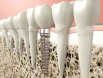 Studio Dentistico Cargini (Abruzzo, Teramo, Viale Cavour Camillo Benso), özel ağız ve diş sağlığı klinikleri ve muayenehaneleri  Abruzzo'dan