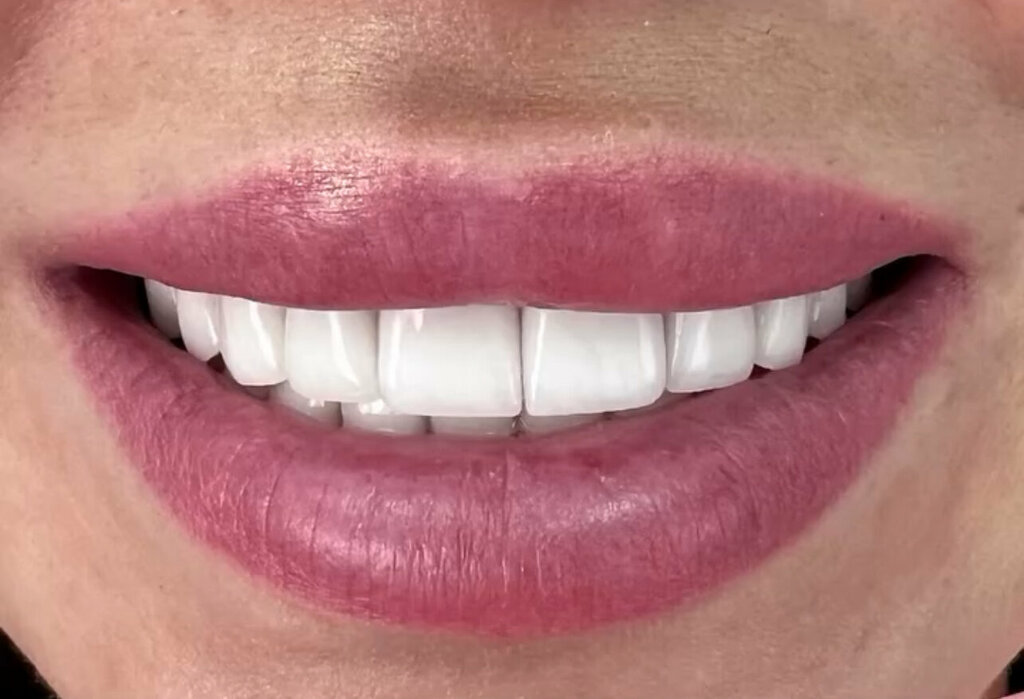 Özel ağız ve diş sağlığı klinikleri ve muayenehaneleri Beauty Dent, Simferopol (Akmescit), foto