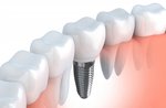 Studio Dentistico Lodi Dott. Paolo (Via Matilde Serao No:9, Ferrara), özel ağız ve diş sağlığı klinikleri ve muayenehaneleri  Ferrara'dan