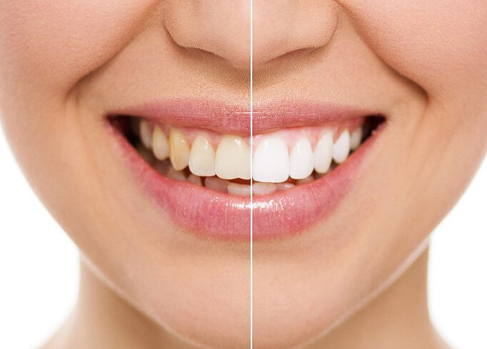 Özel ağız ve diş sağlığı klinikleri ve muayenehaneleri Studio Dentistico Appendino Dr. Guido & Turco Dr. Giovanni, Piyemonte, foto