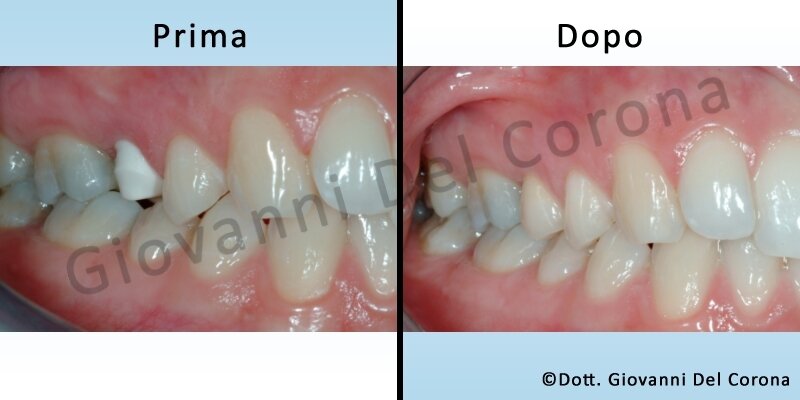 Özel ağız ve diş sağlığı klinikleri ve muayenehaneleri Studio Odontoiatrico Dottor Del Corona Giovanni, Livorno, foto