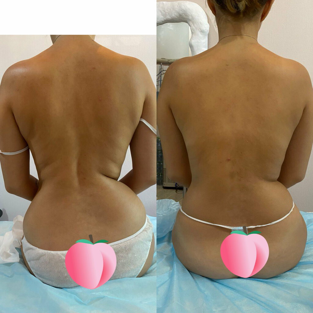 Masaj salonları ОстеоМассаж, Mytişçi, foto