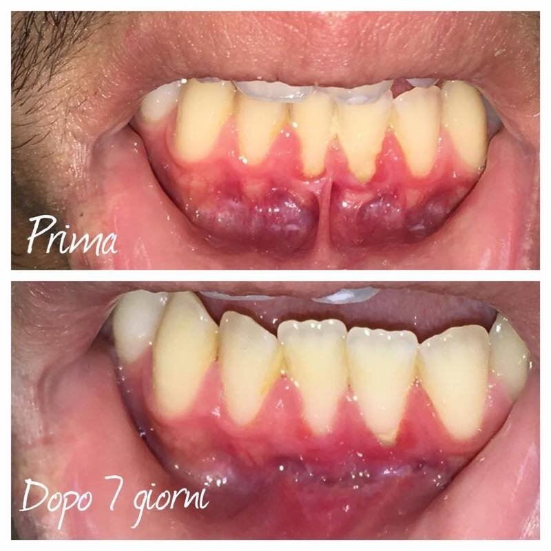Özel ağız ve diş sağlığı klinikleri ve muayenehaneleri Studio Dentistico Sacco Dr. Roberto, Campania, foto
