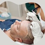 Bilyana Hair Clinic Saç Ekim Merkezi (Antalya, Kepez, Yıldırım Beyazıt Cad., 91), tıp merkezleri ve klinikler  Antalya'dan
