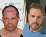 Adonis Med (İstanbul, Üsküdar, Nuh Kuyusu Cad., 94), uzman hizmetleri  İstanbul'dan