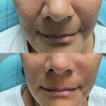 Dr. Helen Valderrama (Distrital La Molina, Jirón Fray Luis de Leon, 229), özel ağız ve diş sağlığı klinikleri ve muayenehaneleri  Lima Bölgesi'nden