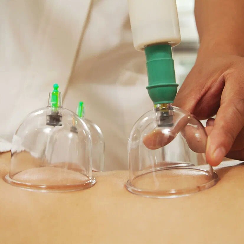 Kozmetoloji, kozmetik salonları Hijama, Miass, foto